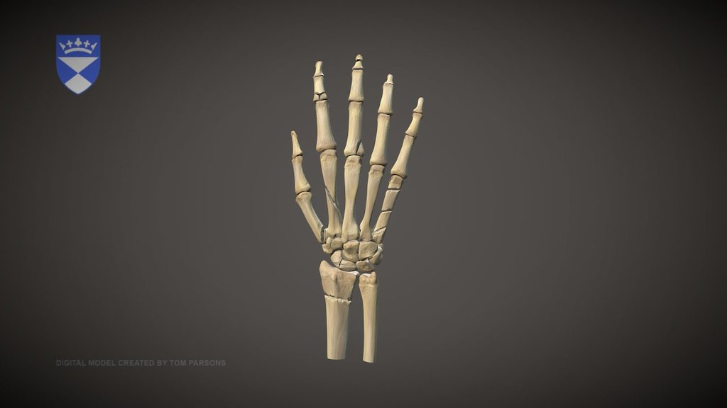 Common Hand Fractures Model - 3D model by University of Dundee, CAHID ...