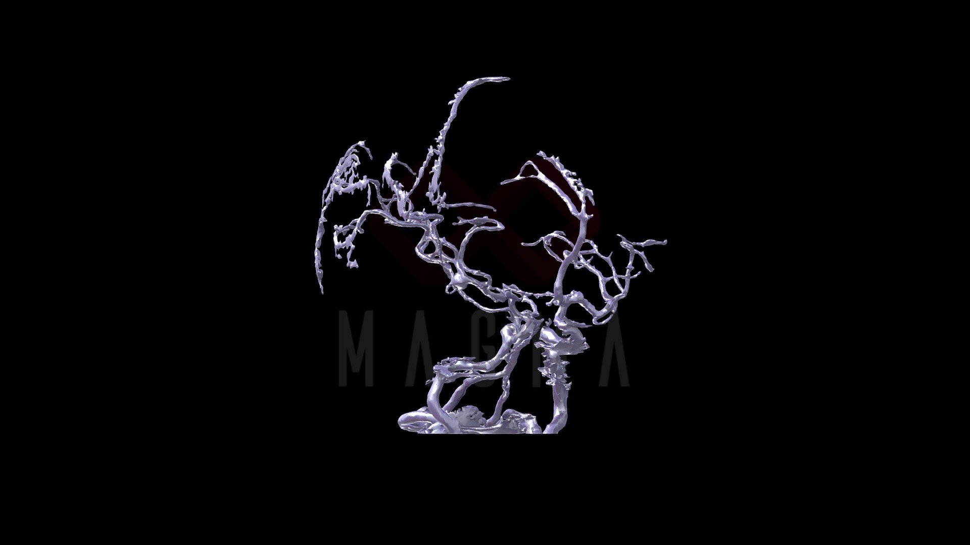 ARO - MCA Aneurysm - 3D model by Dr. Samuel Damin (@sdamin) [e6ad340 ...
