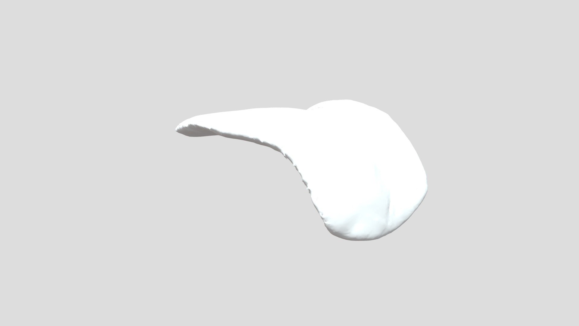 Thumb-plate-qlonescan-metacarpal-02 - 3D model by Mifur [e6b655d ...
