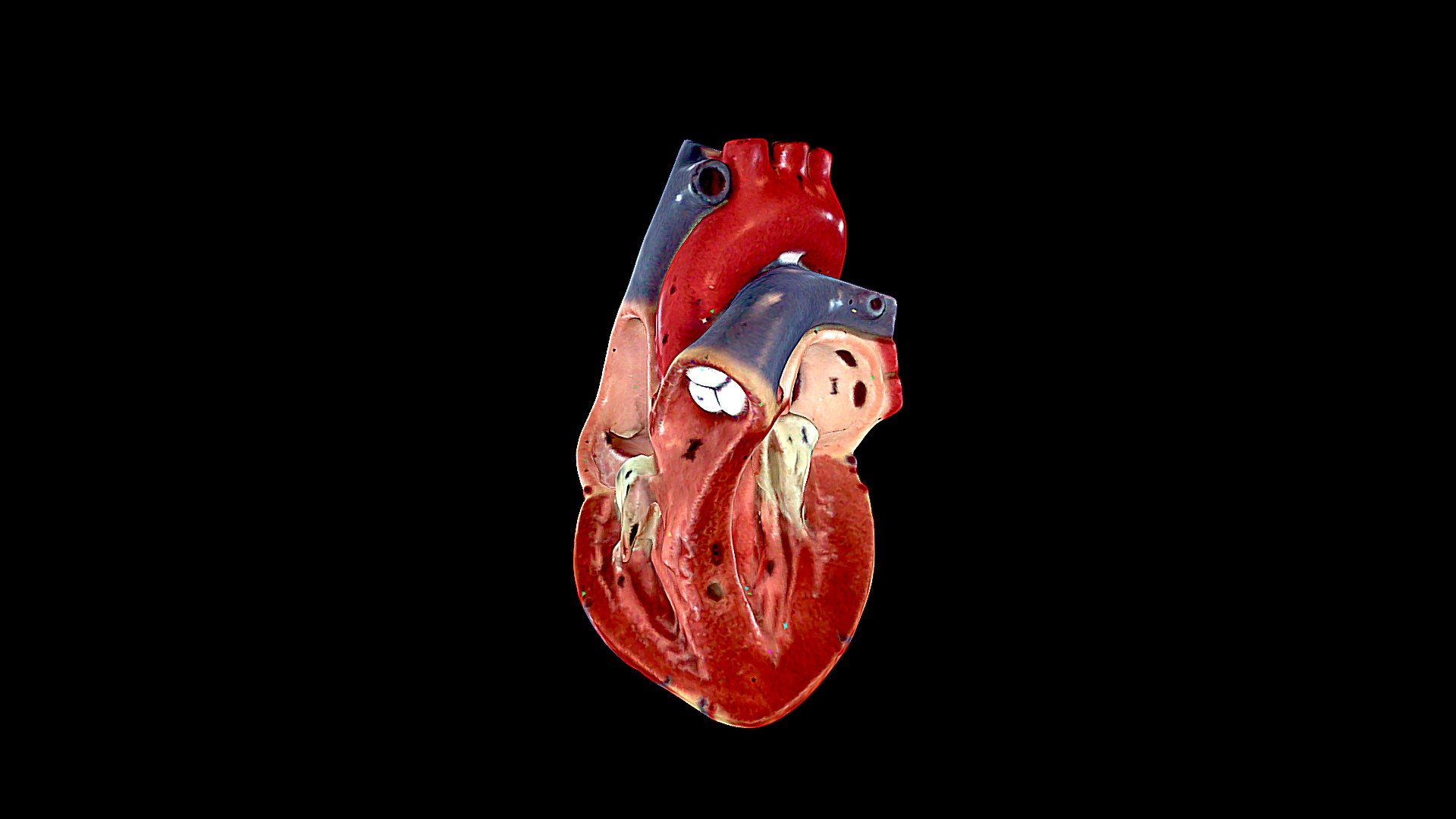 openheart - 3D model by tkanan [e710529] - Sketchfab