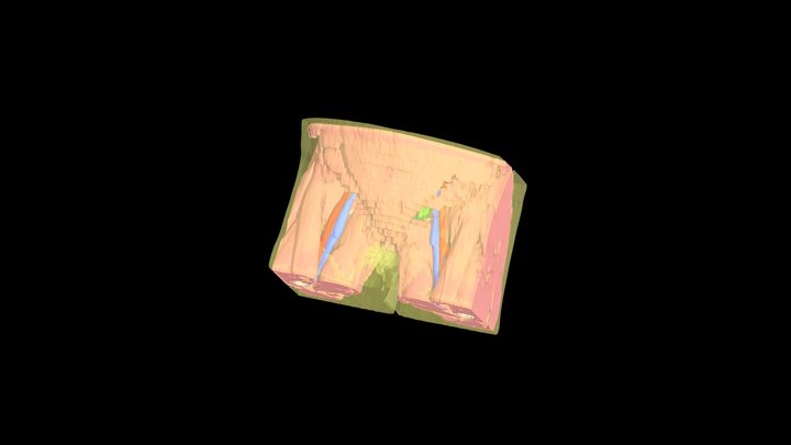 Prostate 3D models - Sketchfab