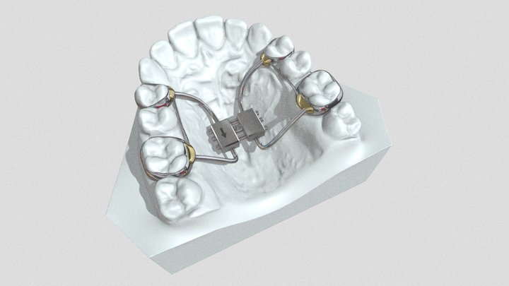 Orthodontics 3D models - Sketchfab