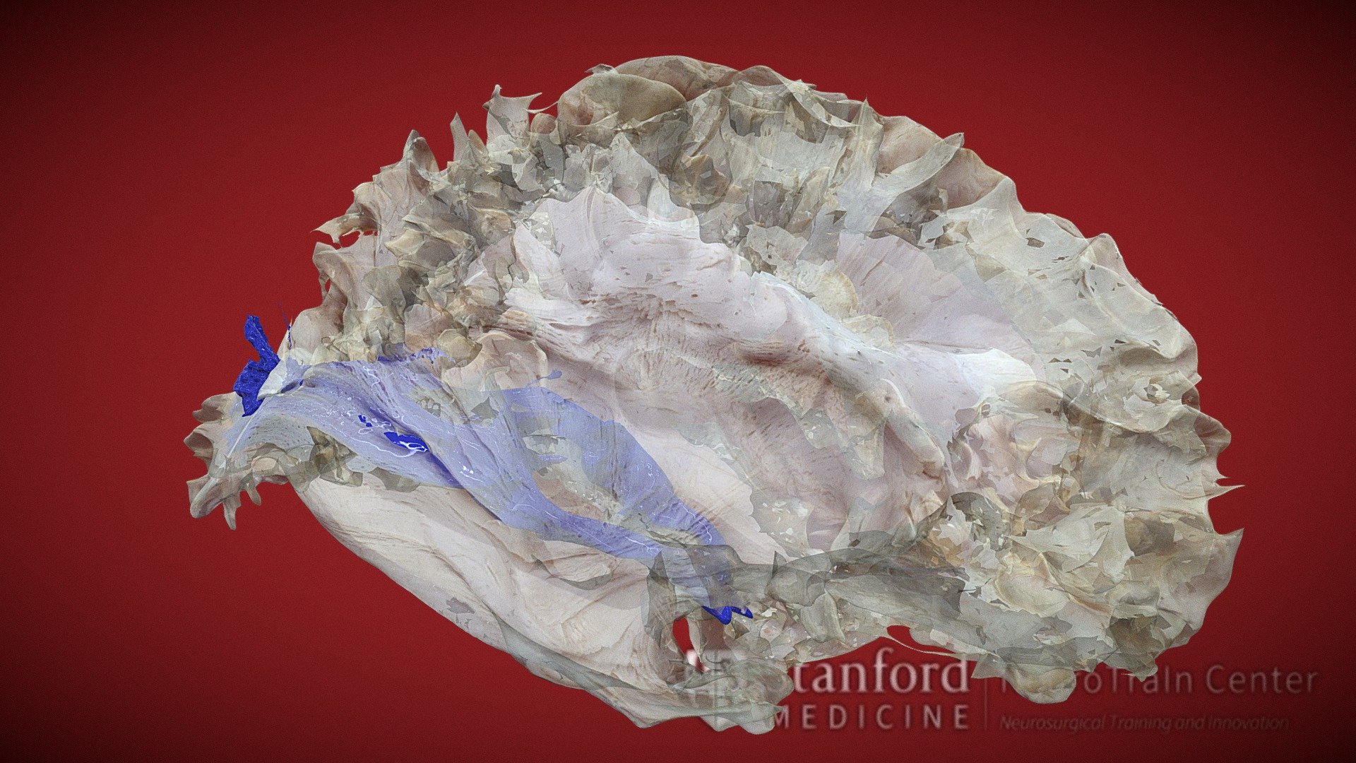 Optic Radiations and Multilayer dissection Brain - 3D model by vv ...