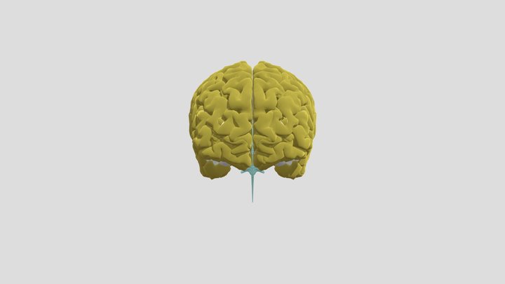3D Neurosurgery (@3dneurosurgery) - Sketchfab