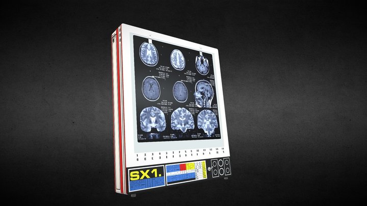Mri 3D models - Sketchfab