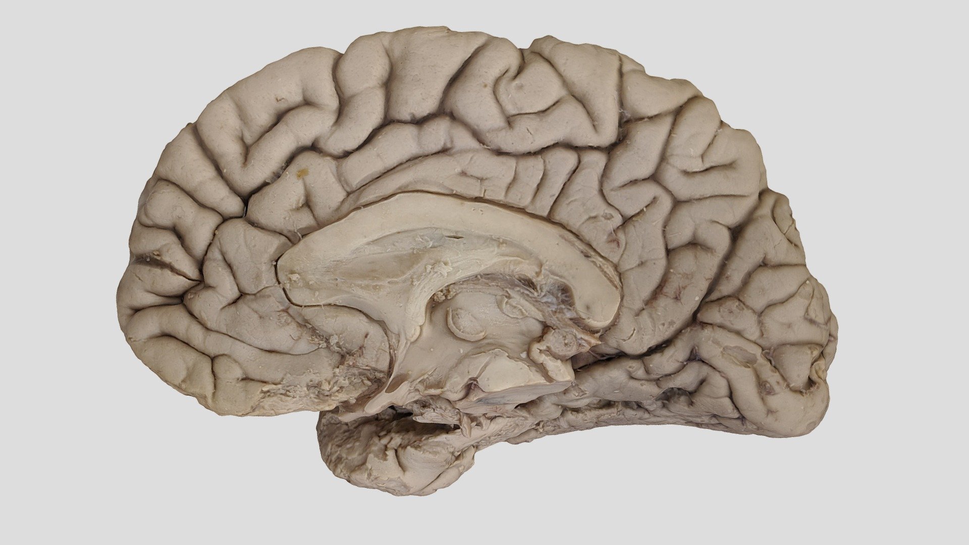 Commissural fibers - Right hemisphere - 3D model by TavorLab (@IT_Lab ...