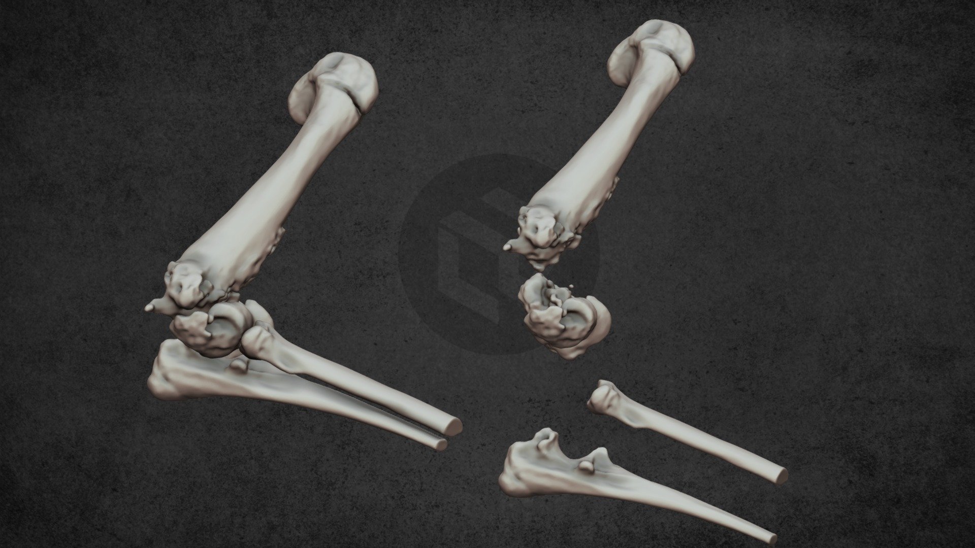 Humeral condylar fracture in a dog (IDF177573) - 3D model by LimesVet ...