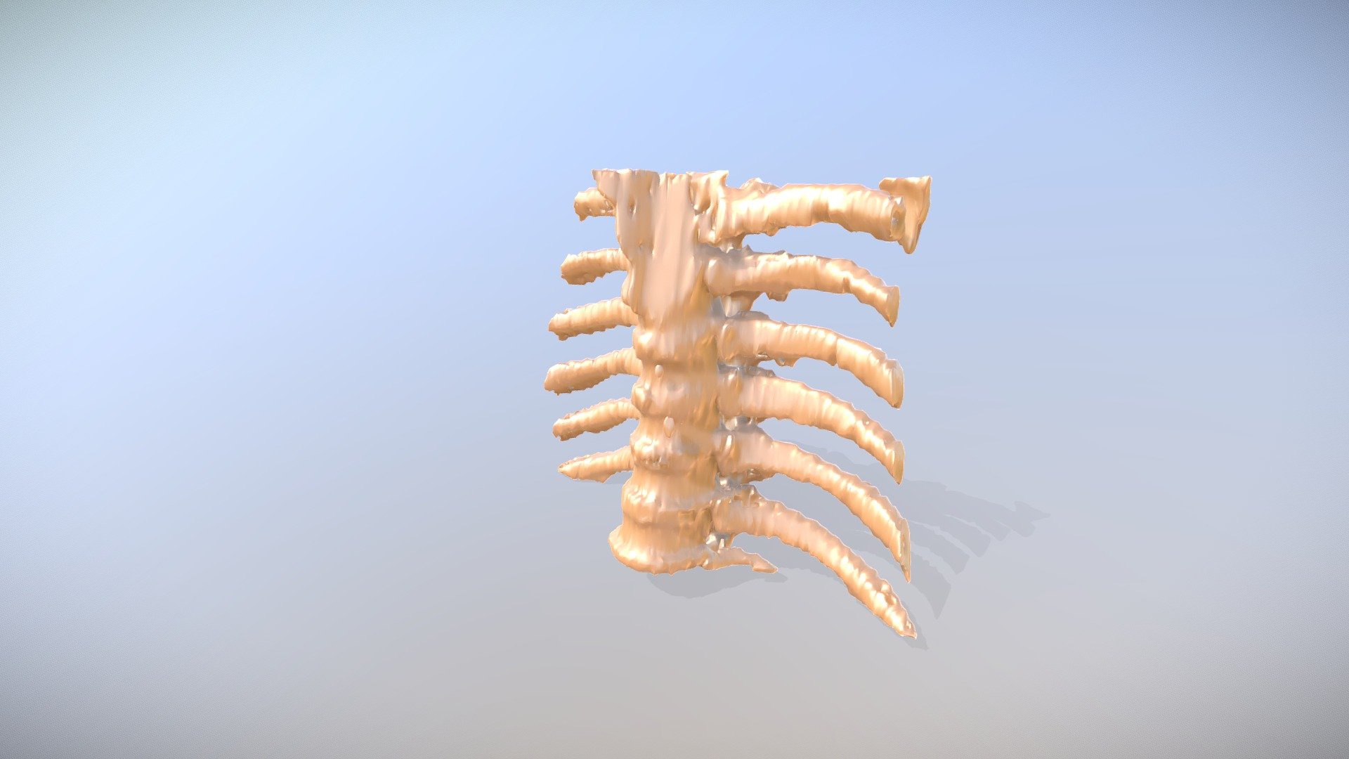 Segmentation_Segment_1 - 3D model by alexhallsgu [e8f3145] - Sketchfab