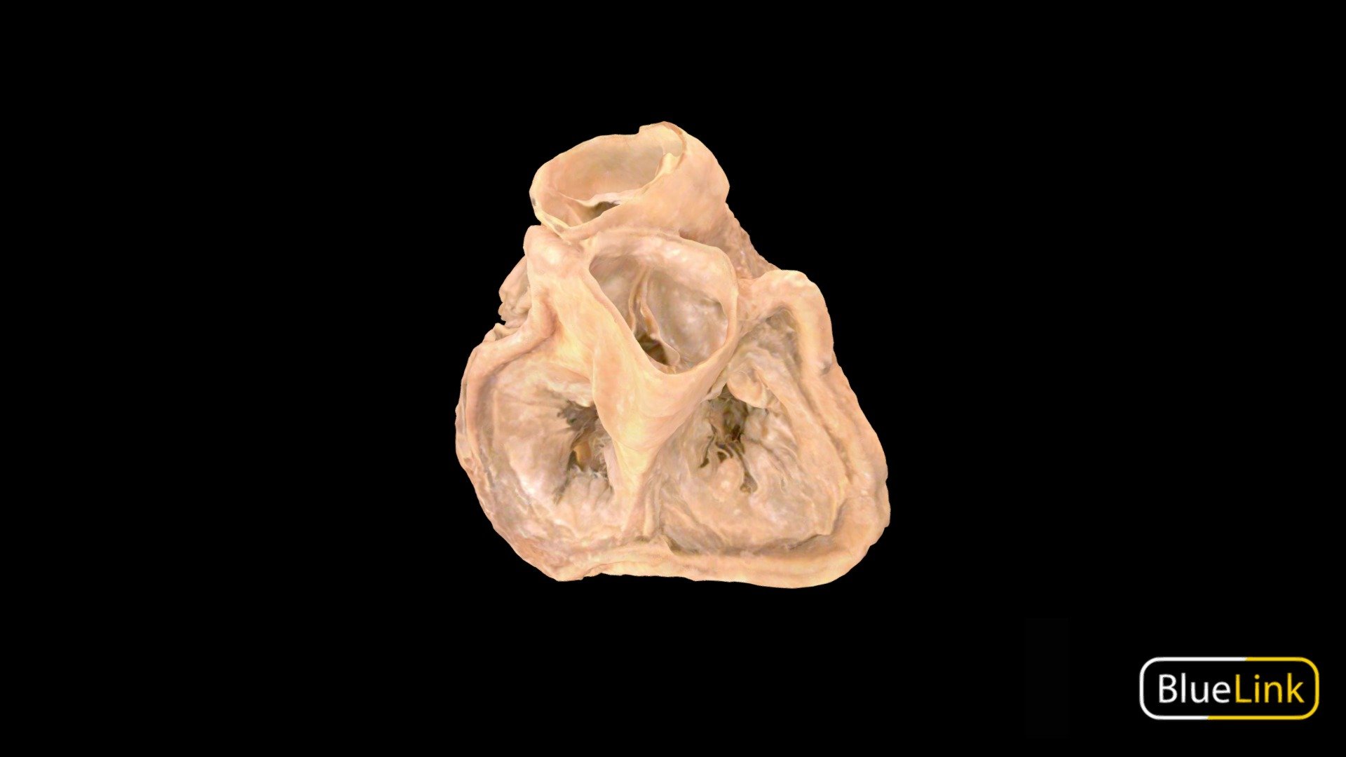 Heart Valves - 3D model by Bluelink Anatomy (@bluelinkanatomy) [e917b9e ...
