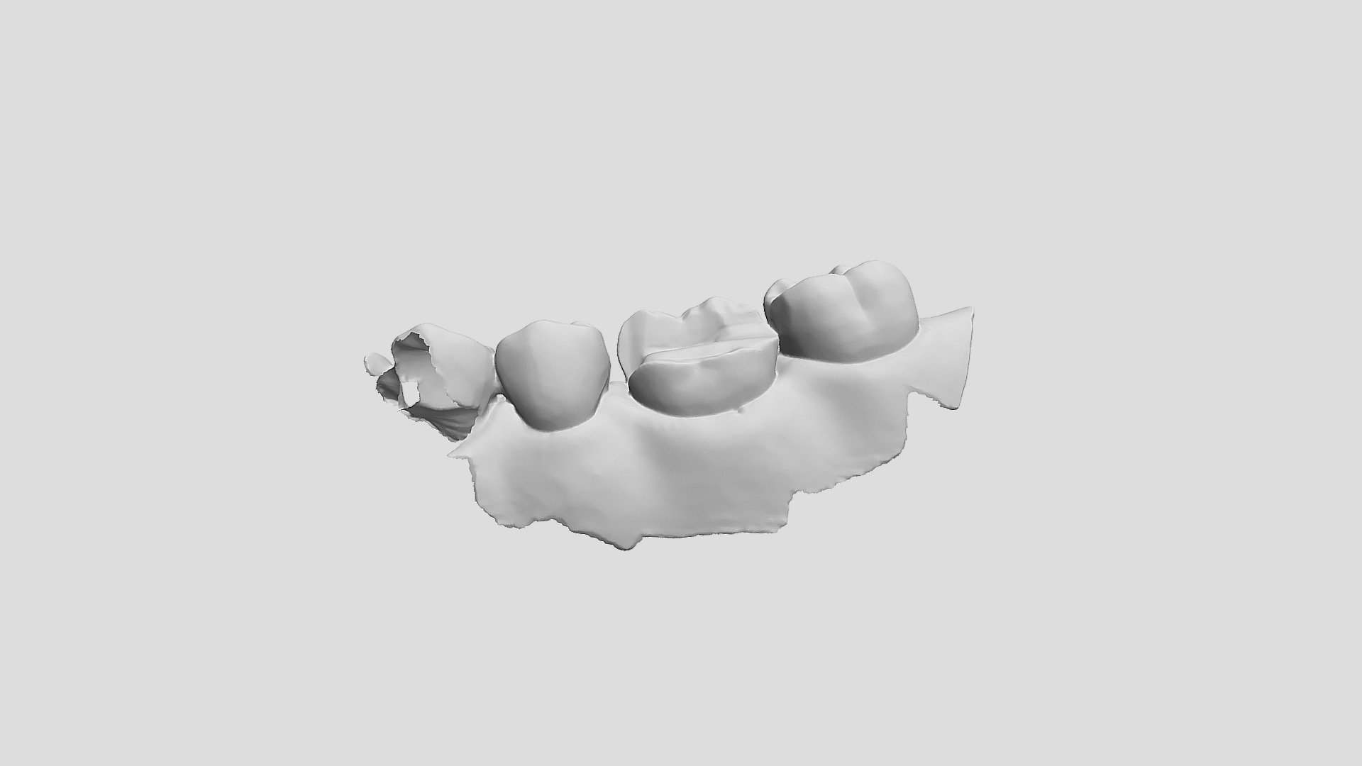 Onlay w/ issue #1 - 3D model by CADucation [e923c4a] - Sketchfab