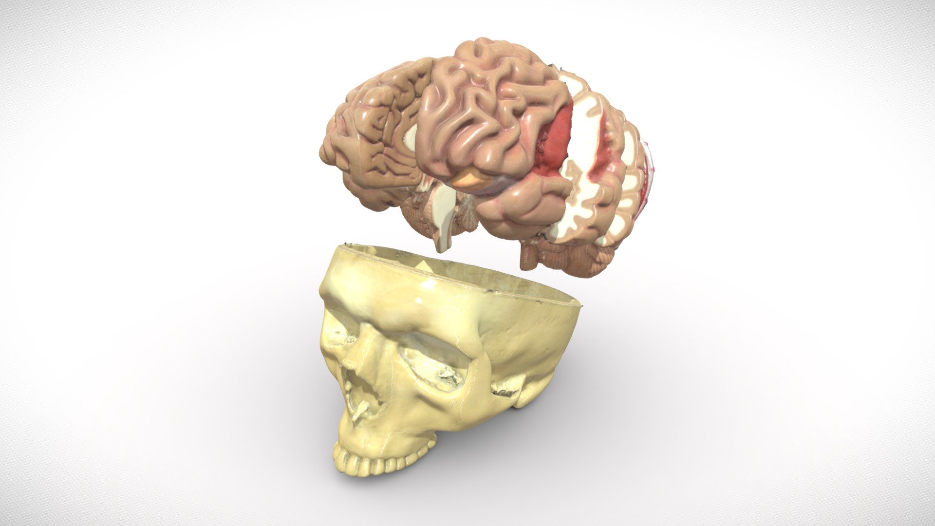Plastic skull with brain: pathologies model - Download Free 3D model by ...