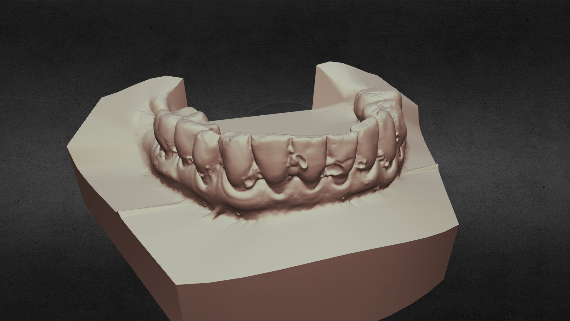 Case LL Mandibular Arch - 3D model by mdentalmargeaux [e9bf301] - Sketchfab