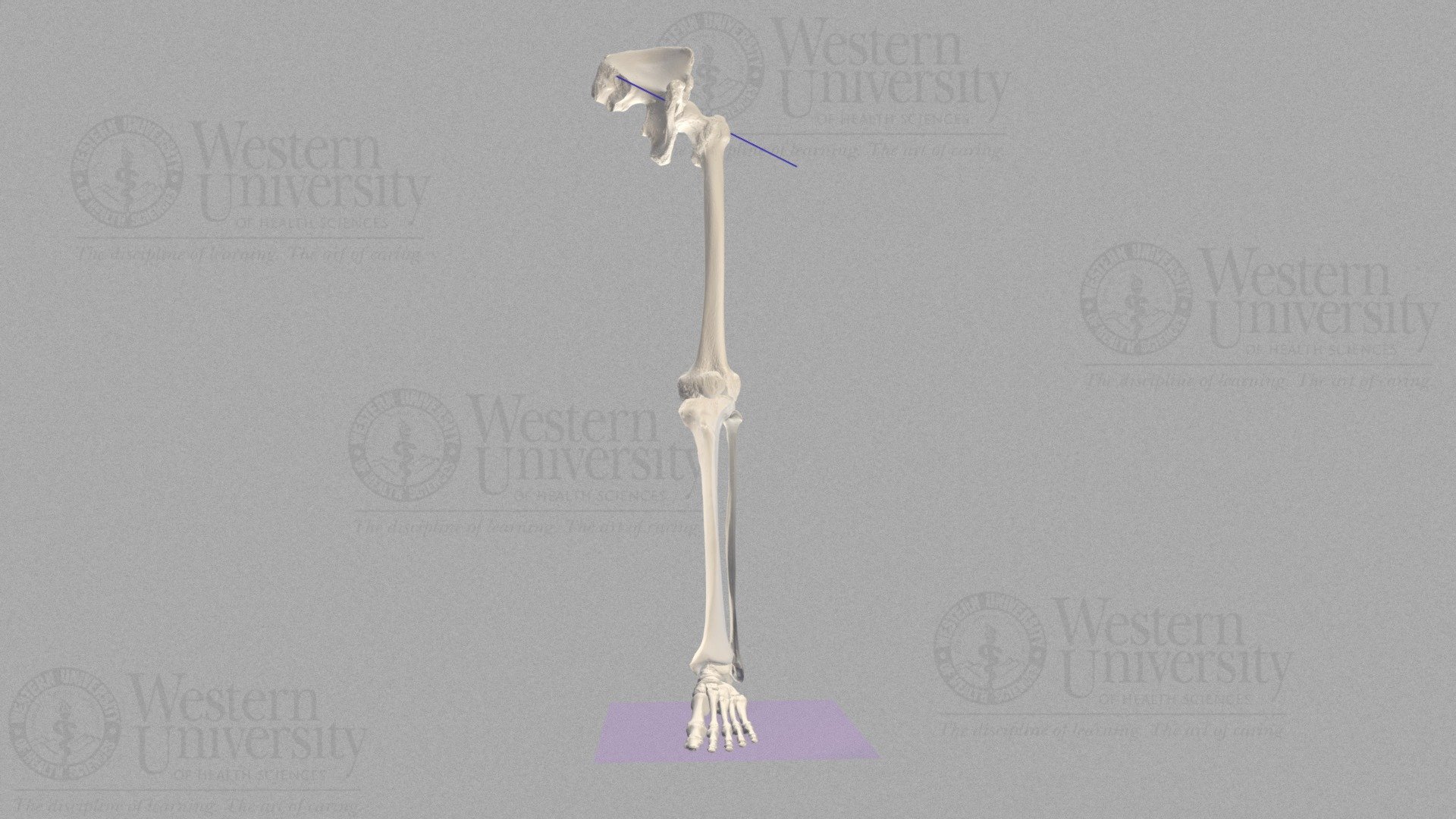 Internal Femoral Torsion with Compensation - 3D model by WesternU3D ...