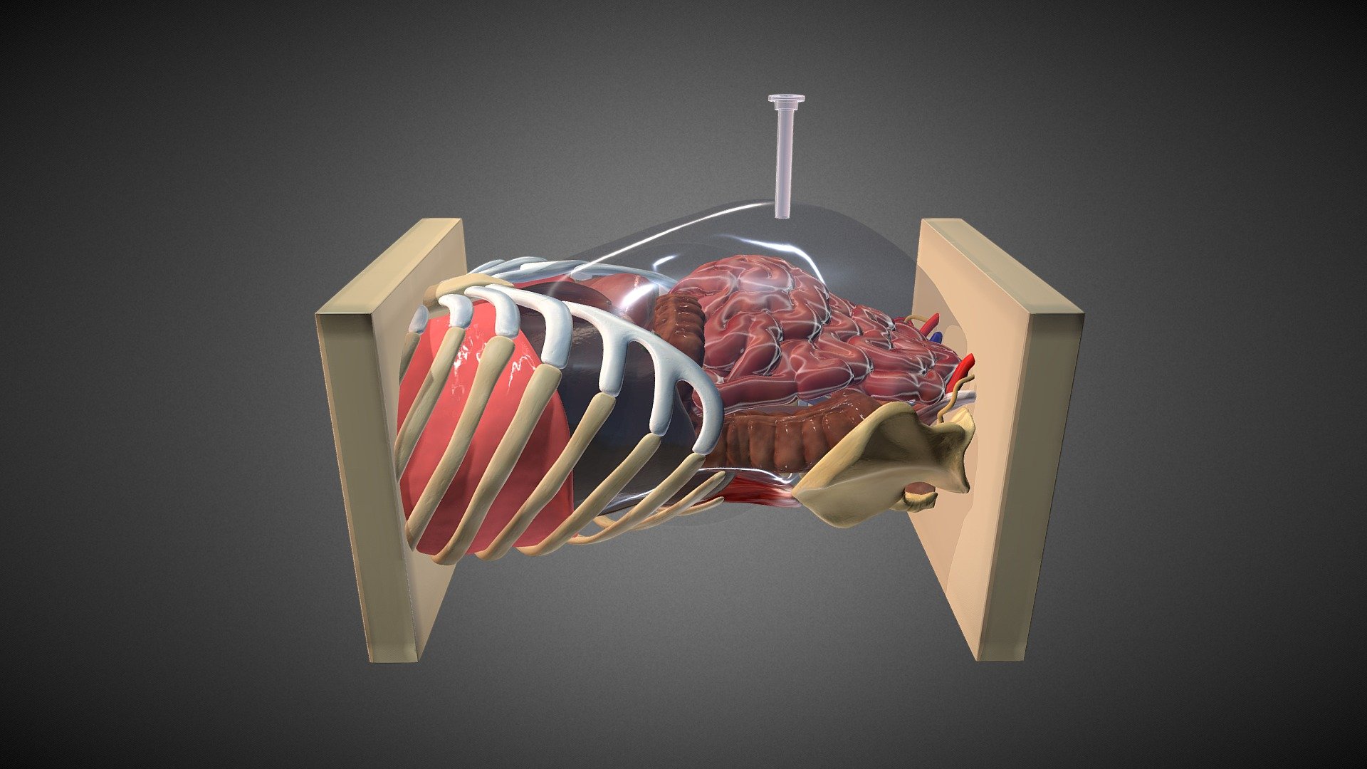 Expert Surgery 3D Animation - 3D model by blendedlearning @LTHTR ...