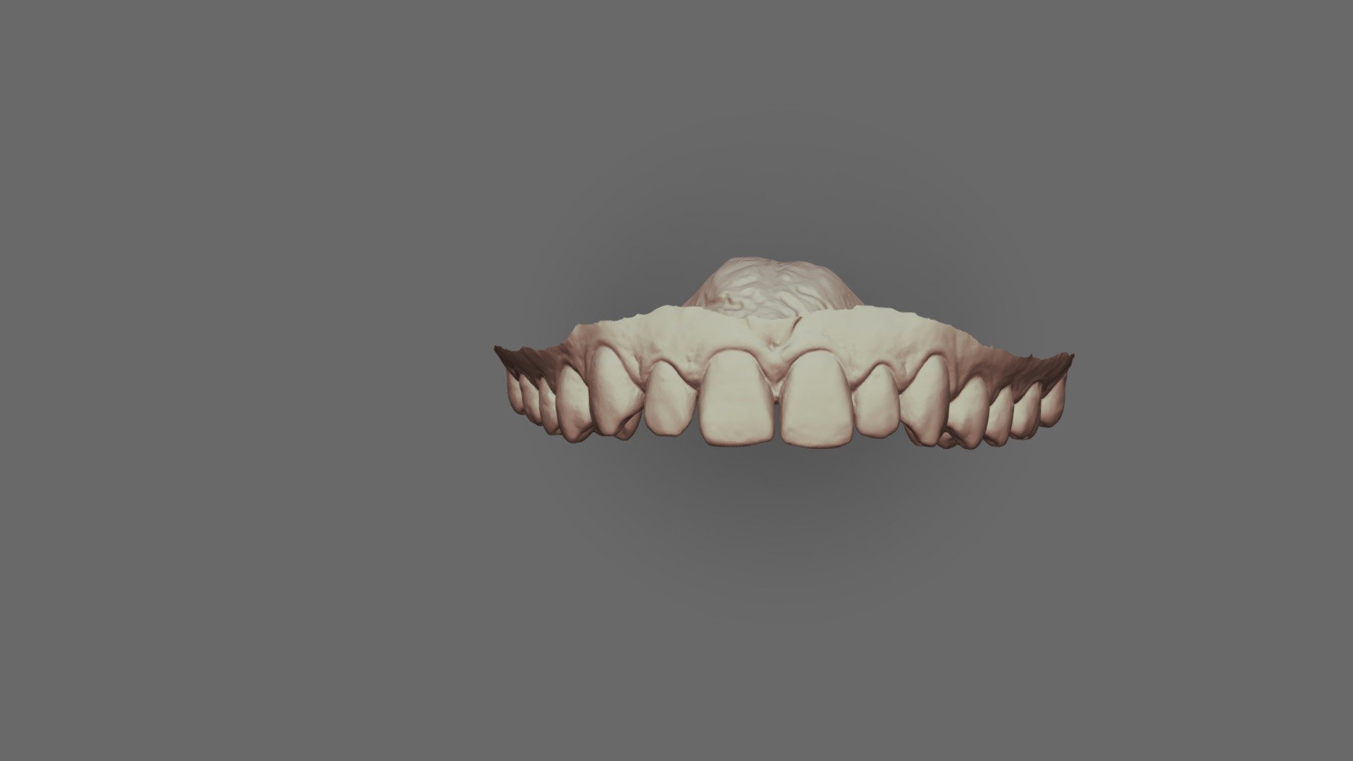 smile makeover 3d mockup - 3D model by skynconcept [e9d8de4] - Sketchfab