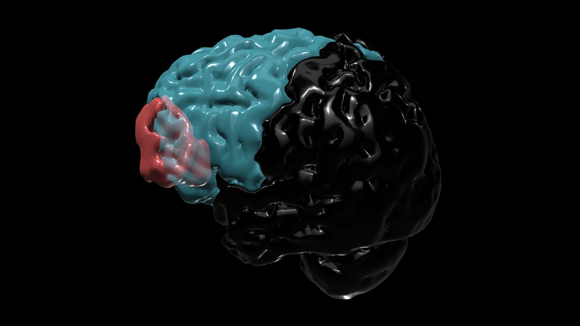 Injured brain highlighting frontal lobe - 3D model by Tracy A ...