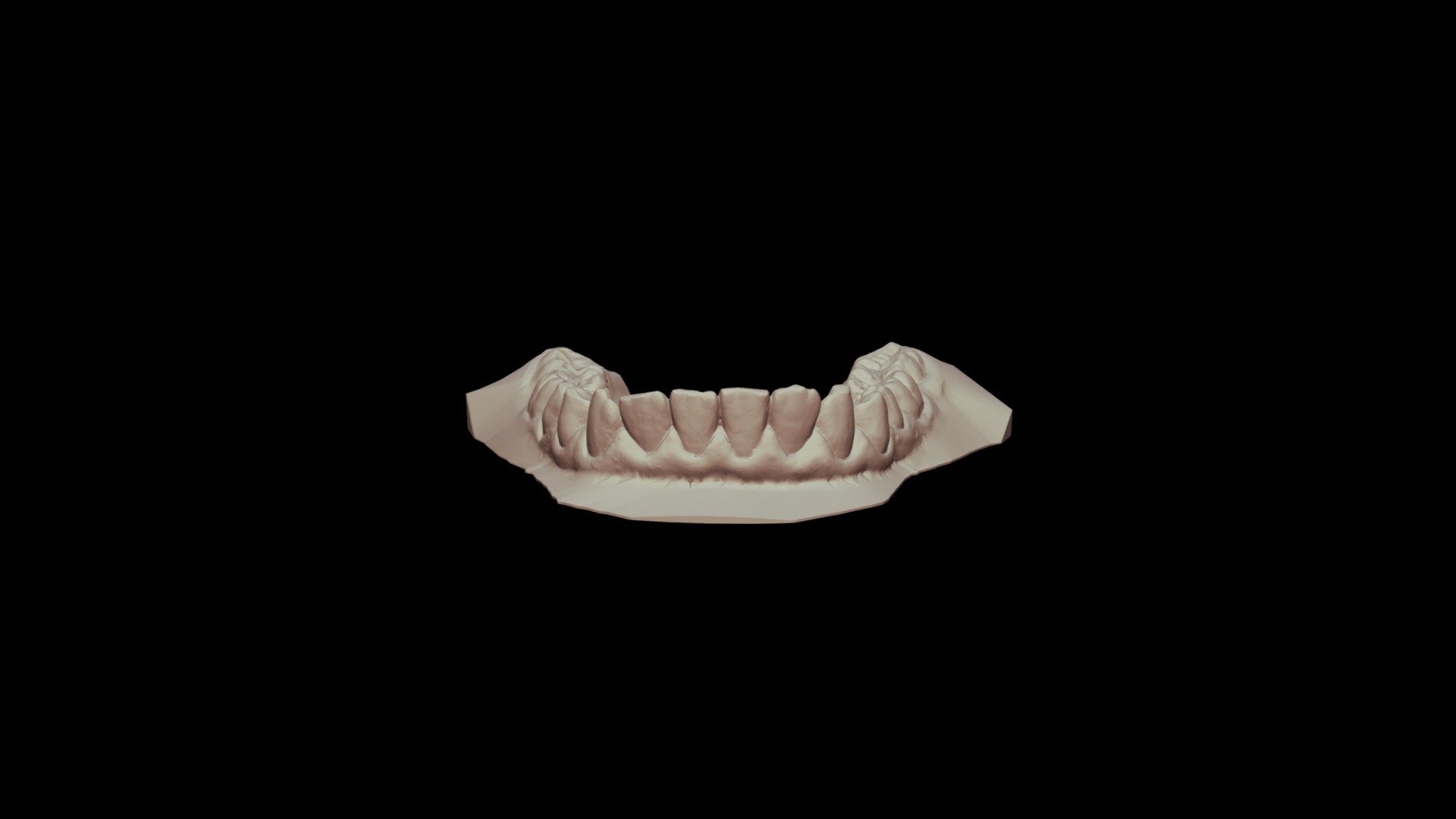Patient 2: Mandibular Cast - 3D model by bchui [ea8ff54] - Sketchfab