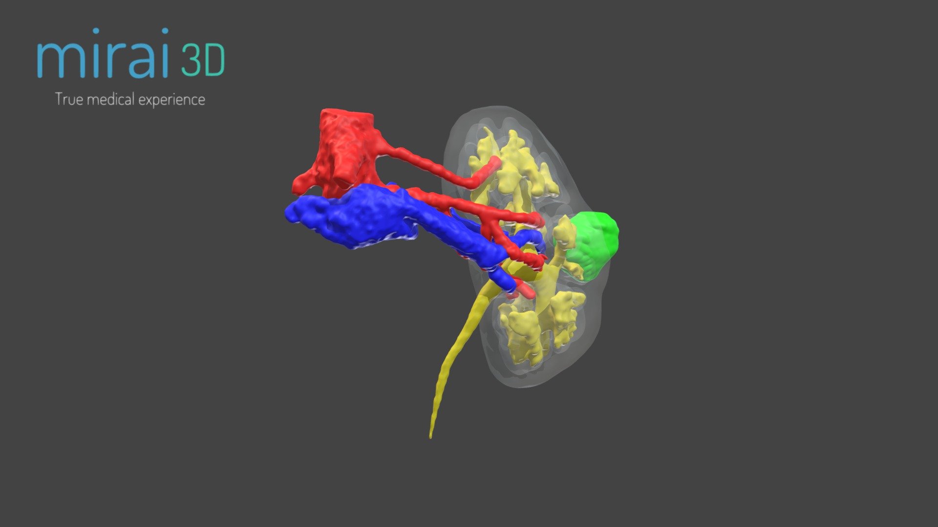 Medical Model WP68 - Urology - 3D model by MIRAI3D [eaa574f] - Sketchfab