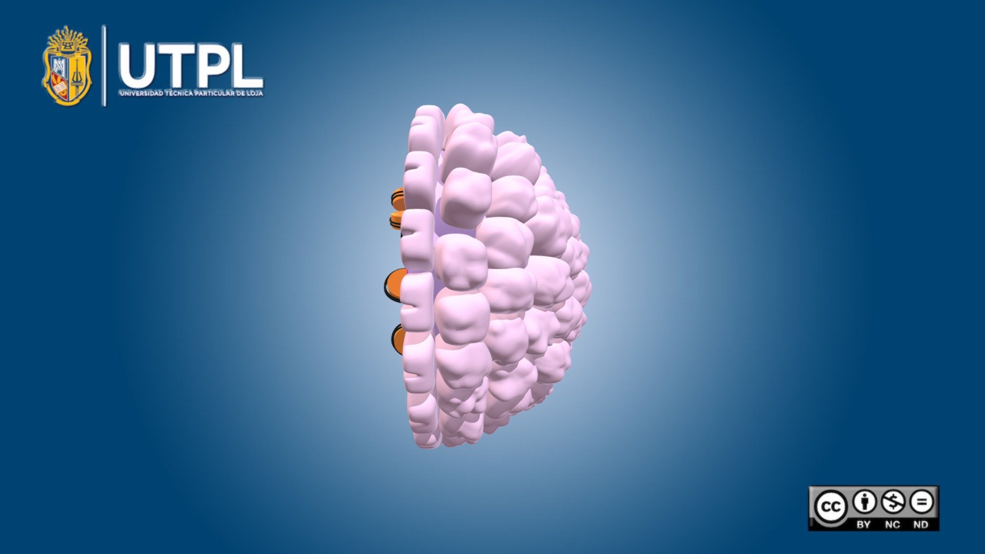 VPH - Download Free 3D model by 3D_UTPL [eaafac7] - Sketchfab