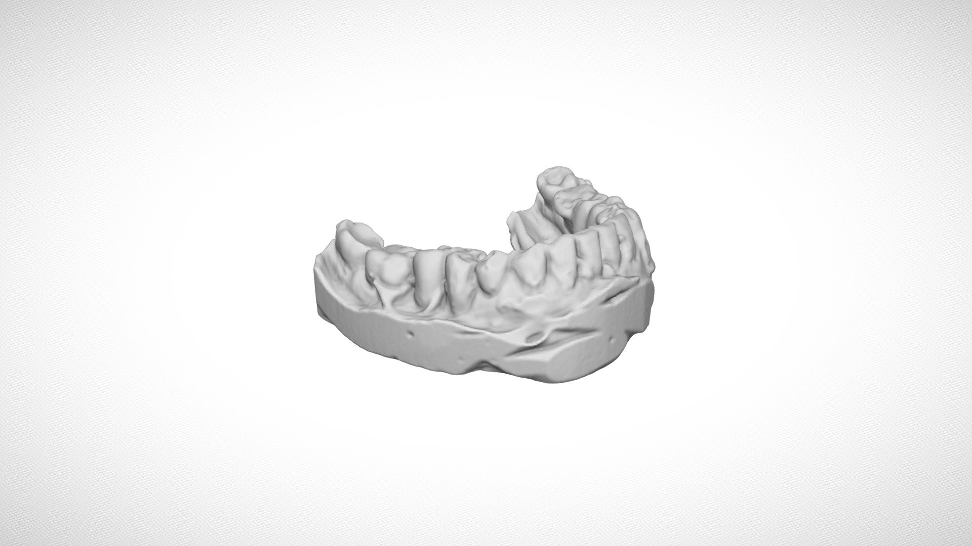 Jaw - Download Free 3D model by rvscanners [eb296b0] - Sketchfab