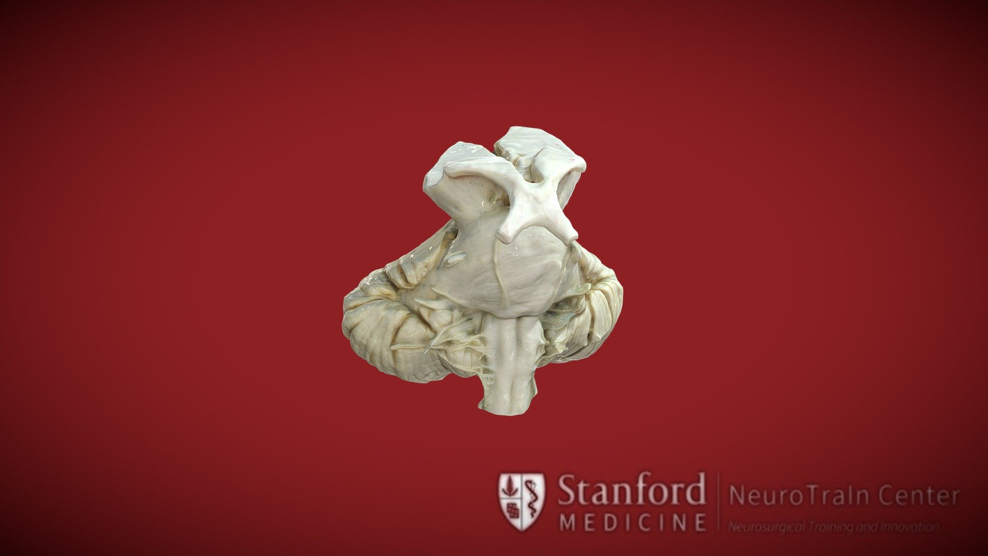 Brainstem 2 - 3D model by vv (@verav) [eb5adae] - Sketchfab