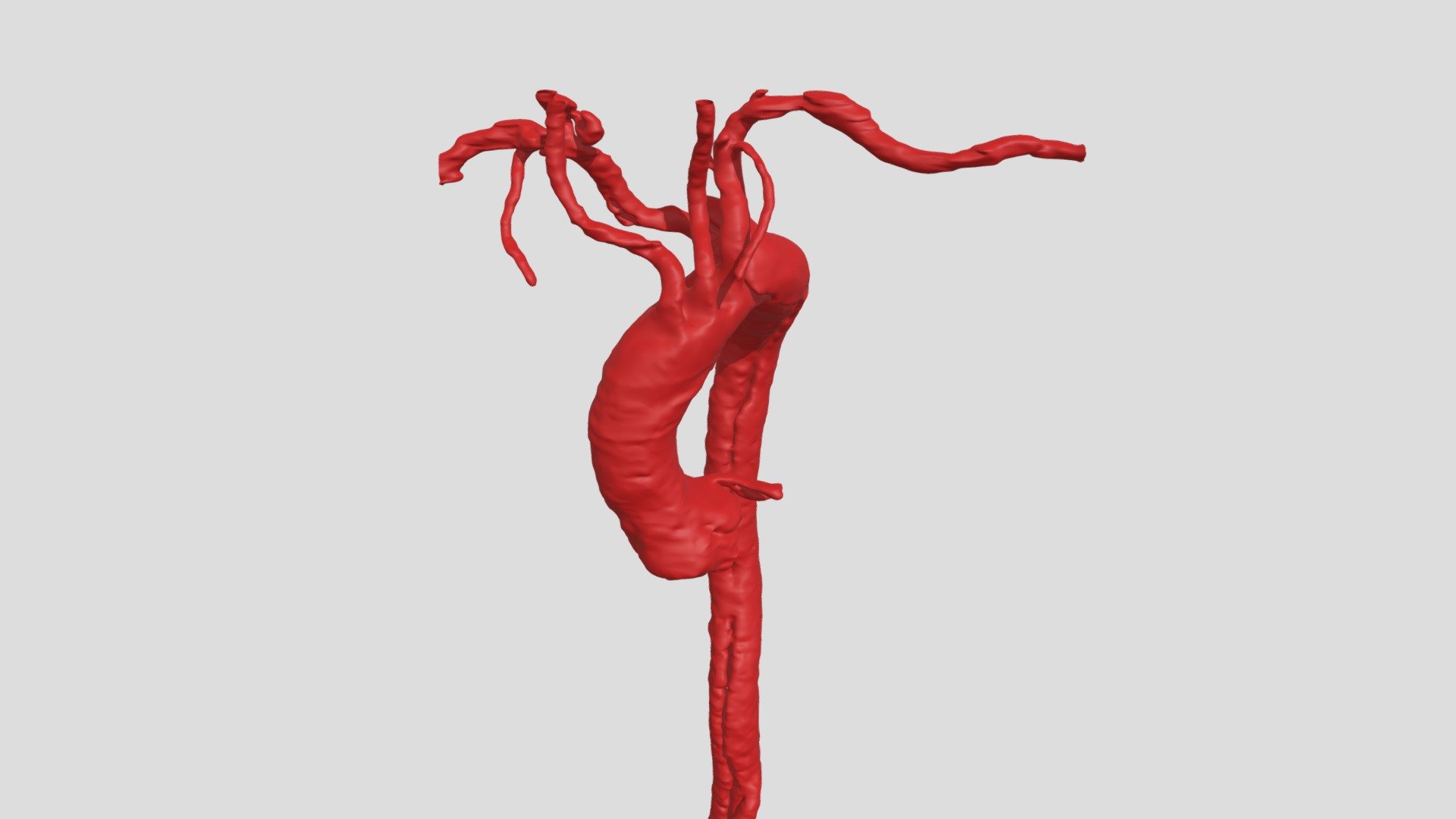 A22ML14052021_AORTA completa - Download Free 3D model by 3Dsurgery ...