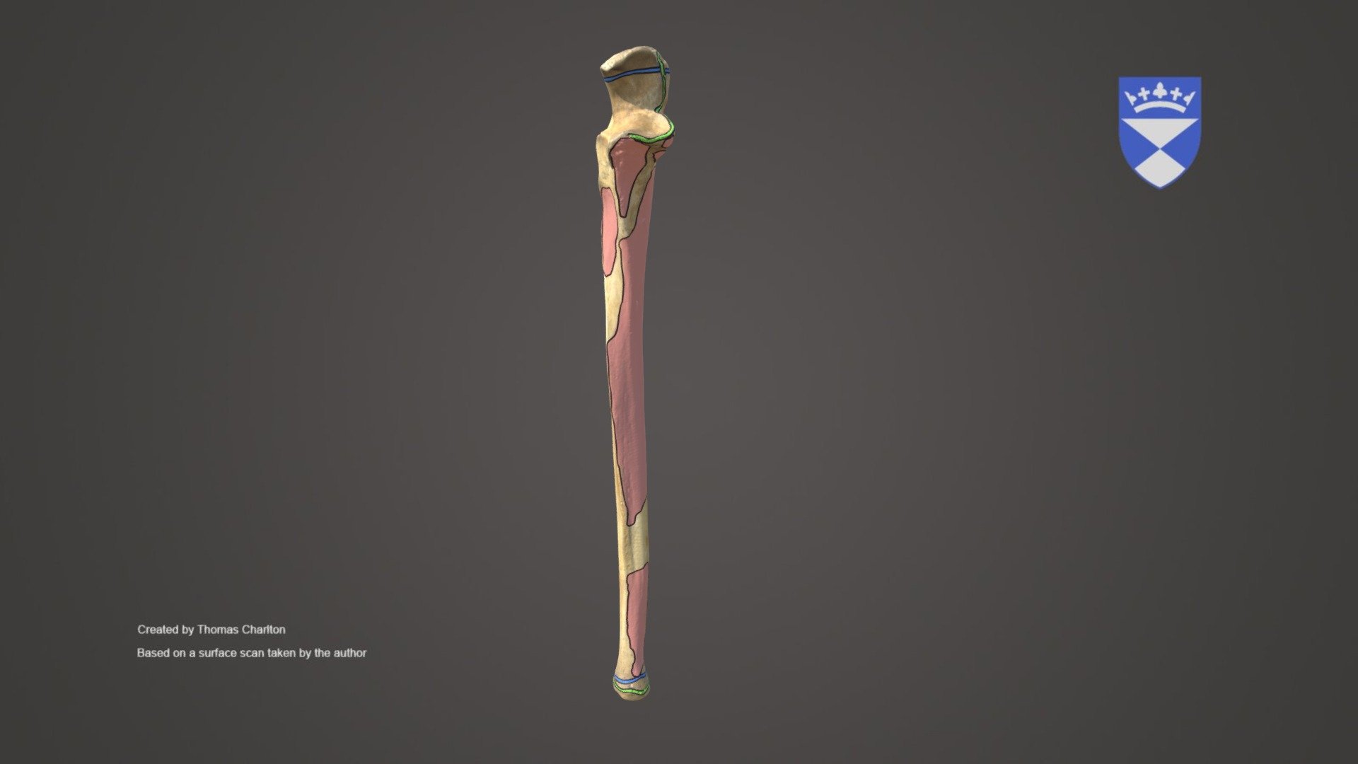 Ulna - 3D model by University of Dundee, CAHID (@anatomy_dundee ...