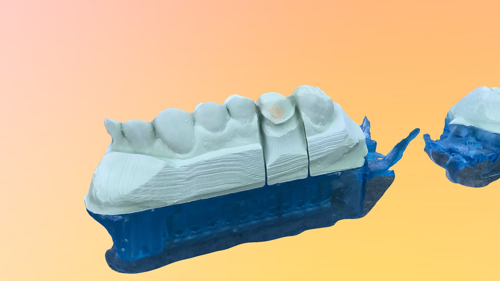 Teeth1 - 3D model by peter54 [ed0aeeb] - Sketchfab