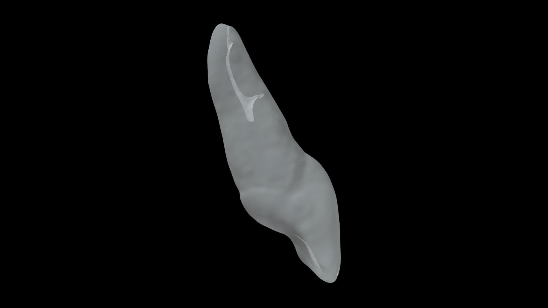 9 Calcified - 3D model by biomed3d [ed0d5bf] - Sketchfab