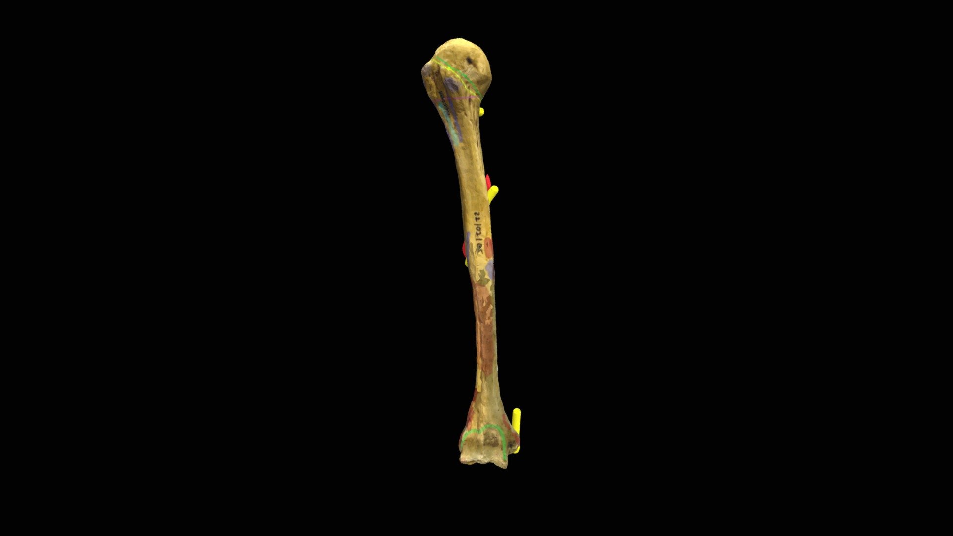 Humerus lower end - Download Free 3D model by prajjawalit [ed5b5c4 ...
