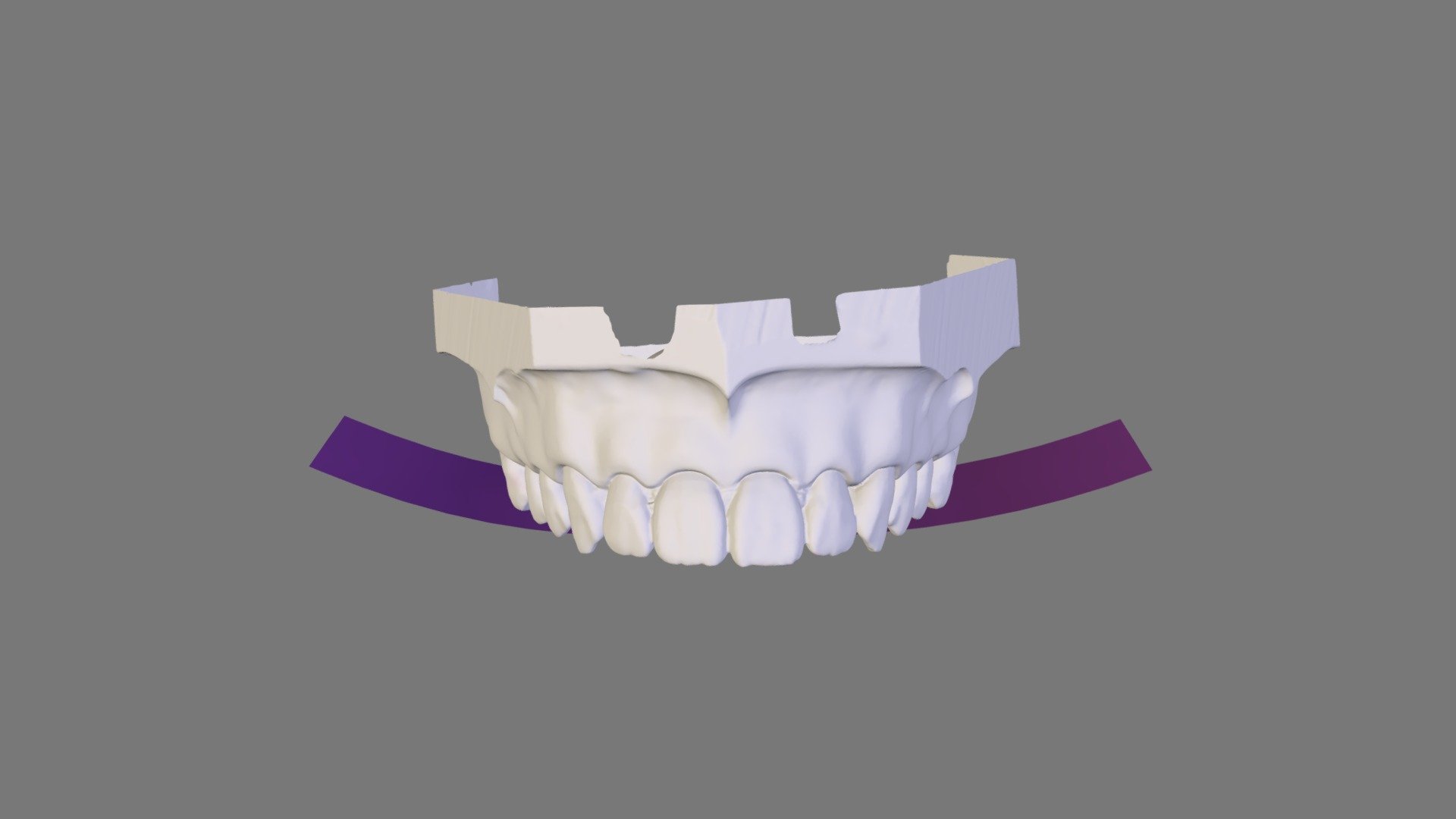 Modelo Superior com curva de Wilson - Download Free 3D model by Ricardo ...