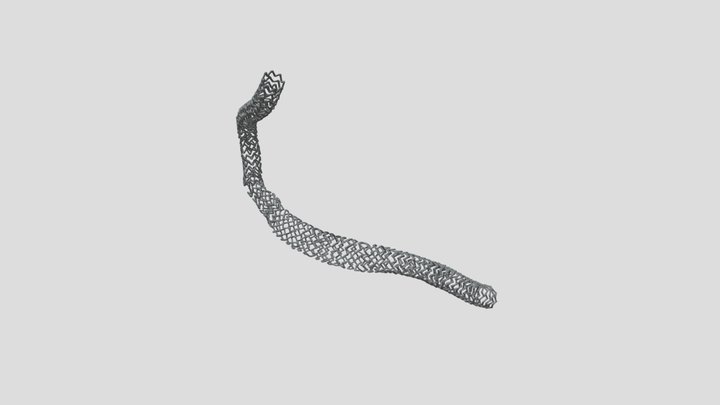 Stent 3D models - Sketchfab