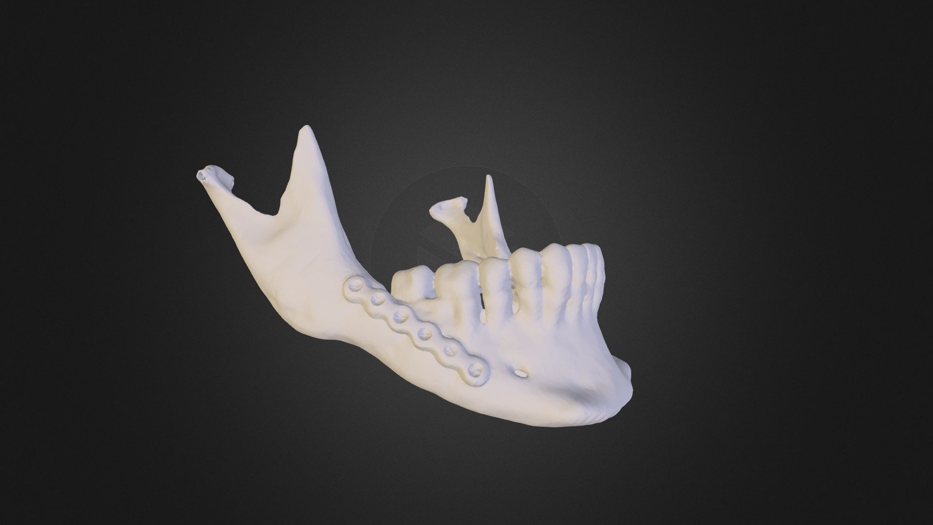 Mandible - 3D model by drhughharvey [ee02d27] - Sketchfab