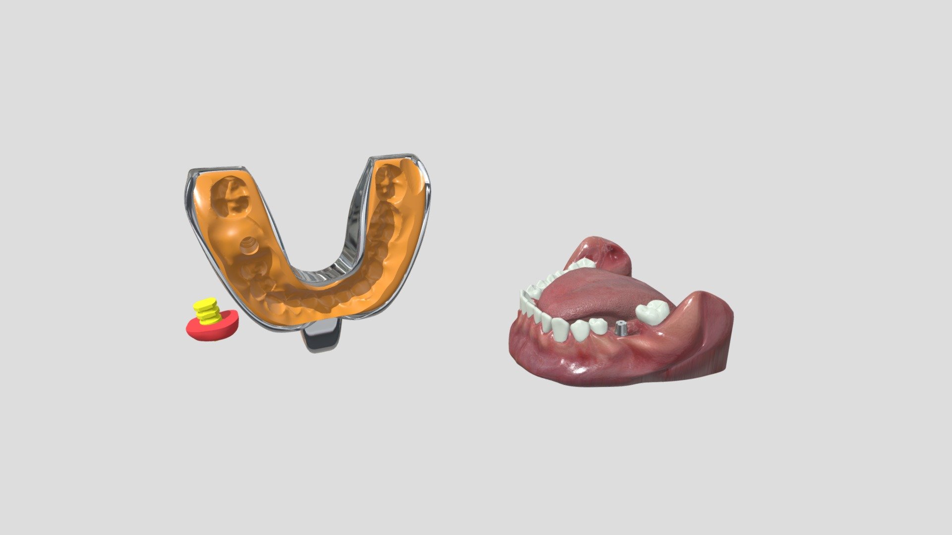Closed-tray impression - 3D model by Mateus Bertolini (@mateusbertolini ...
