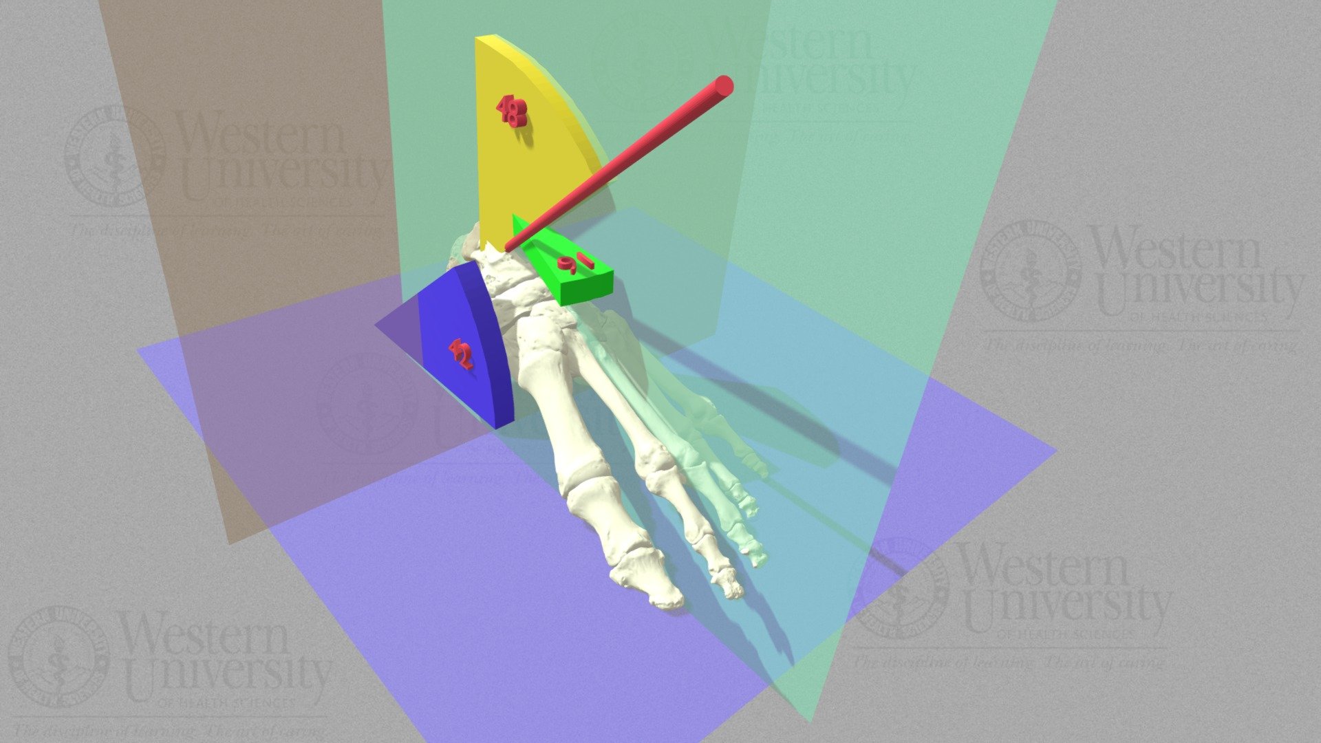 Subtalar Joint Axis Angle Measurements - 3D model by WesternU3D ...