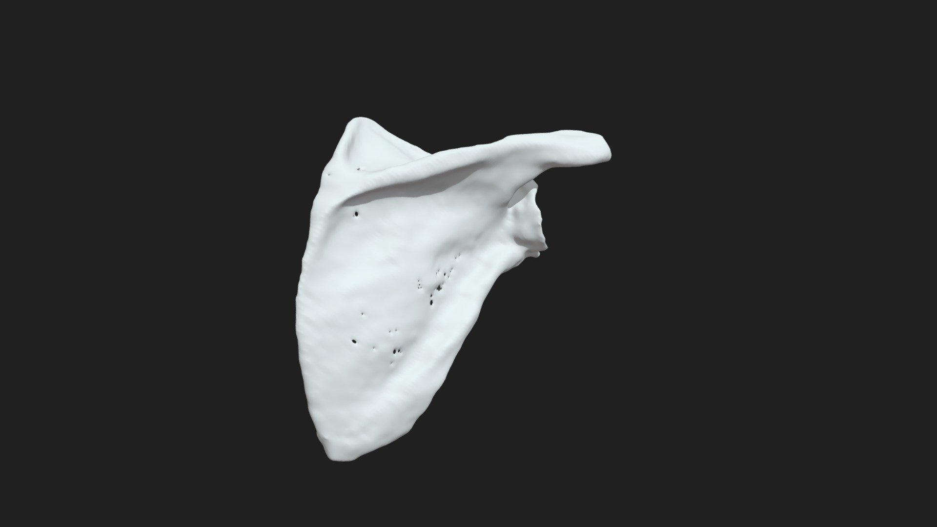 Right Scapula Reconstruction - 3D model by Umesh Persad (@upersad ...