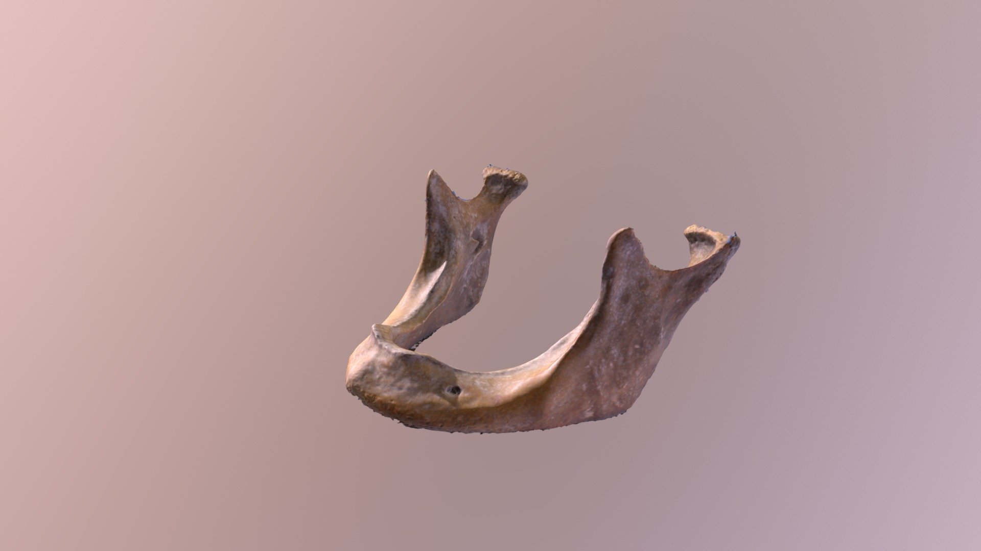 Mandibula edêntula - Edentulous mandible - 3D model by dr.miamoto ...
