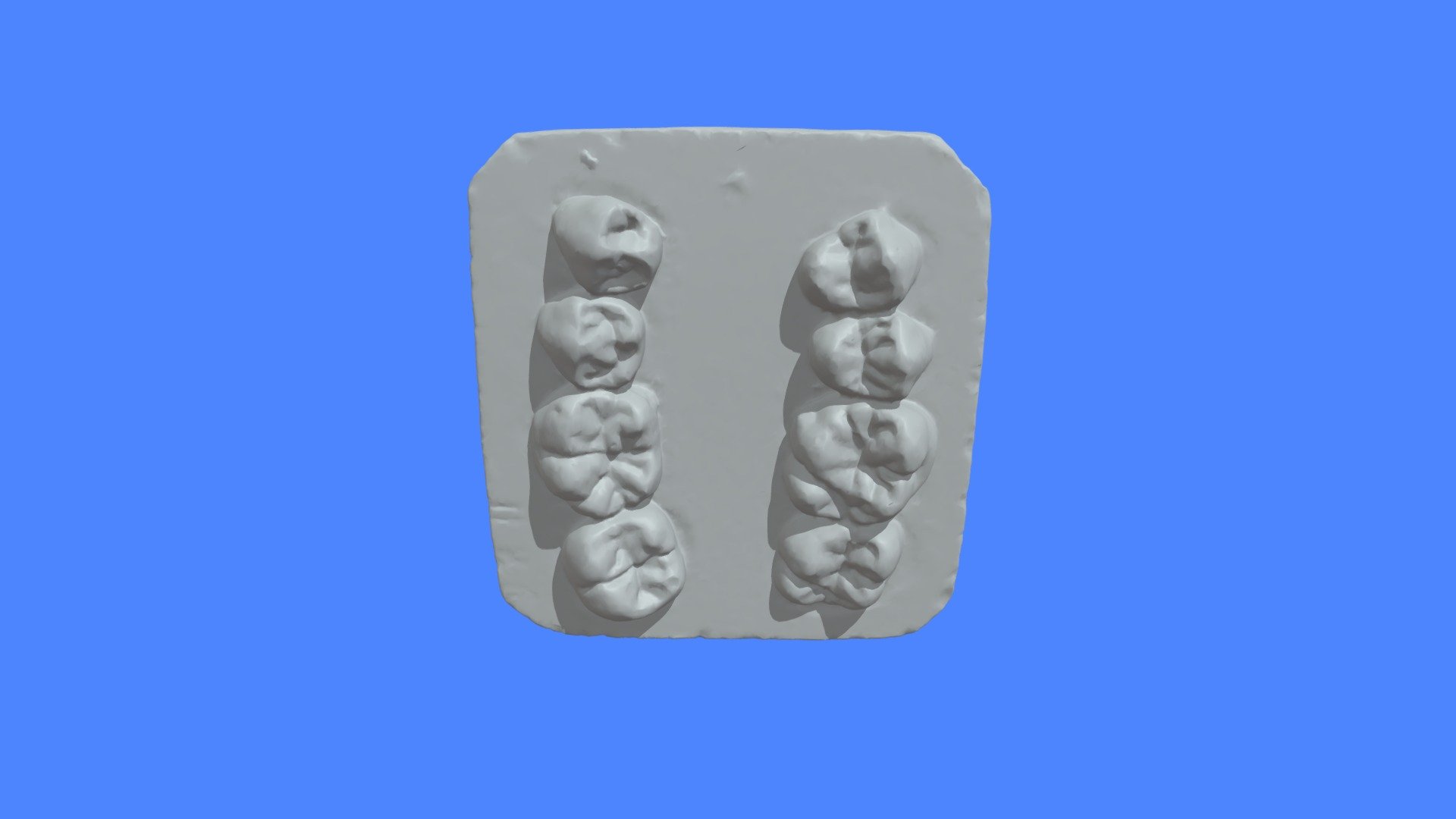 Dental Occlusal Model - Download Free 3D model by Davide Specchi ...