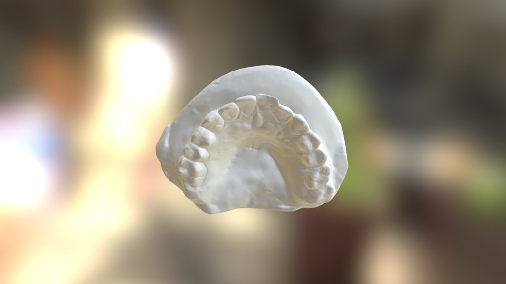 IT3D-2016-10-03-001- Teeth Scan - 3D model by ImagineThat-3D [ef383e3 ...