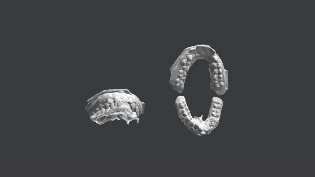 Ortho Study Models sr12 - Download Free 3D model by drpcnaidu [ef47849 ...