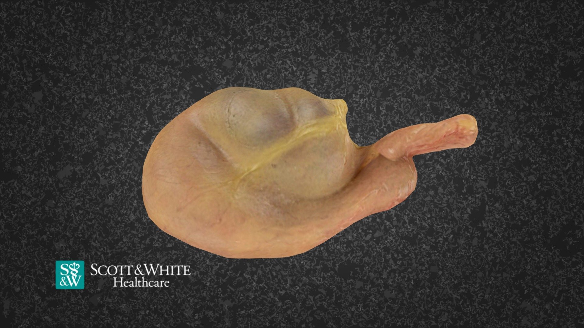Bladder 90696 - 3D model by Scott & White Moulage Project (@swmoulage ...