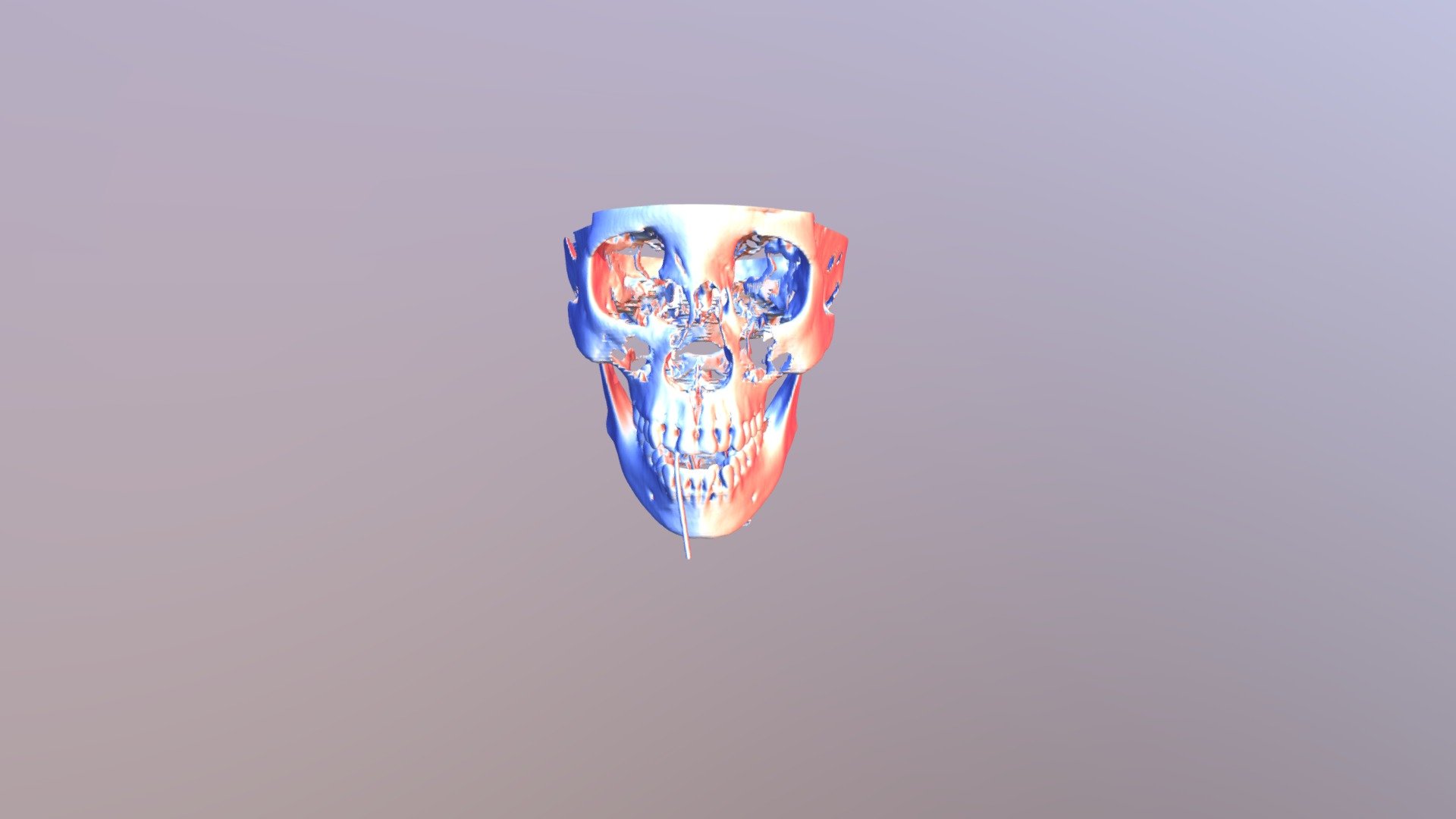 3D model of headsq.vti dataset. - 3D model by Adheesh (@aaphadke ...