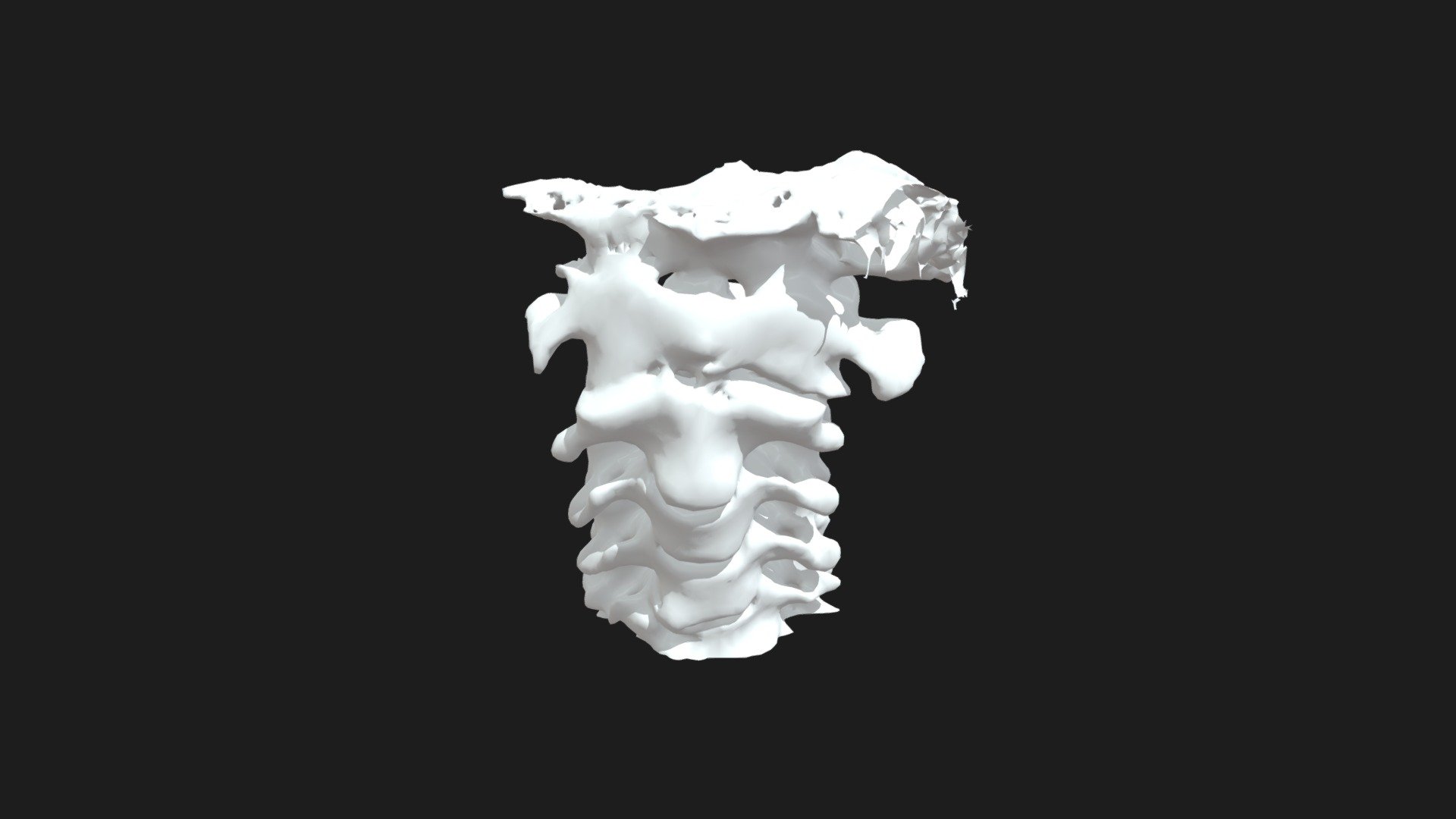 Upper Cervical III type A (2nd) - 3D model by MT.MD [eff61cf] - Sketchfab