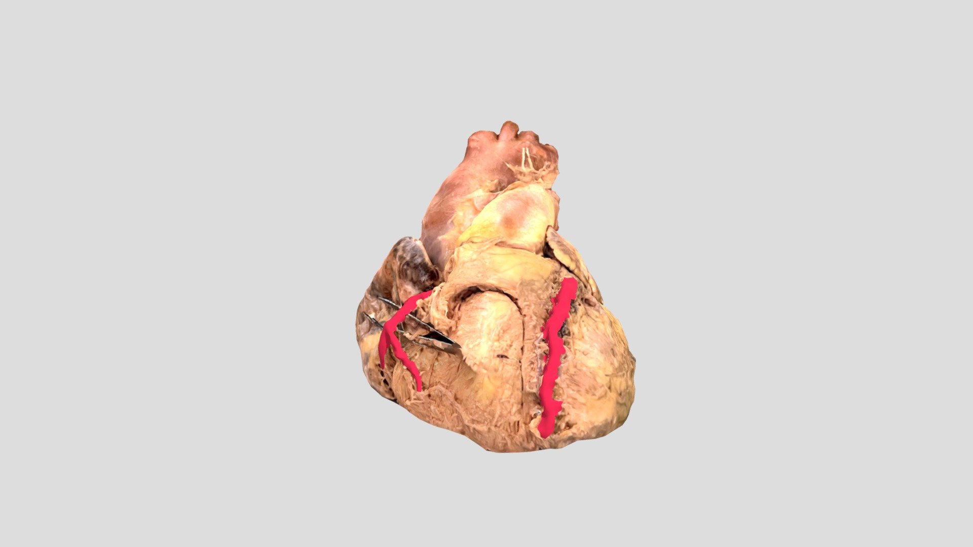 heart - 3D model by prajjawalit [f004d0a] - Sketchfab