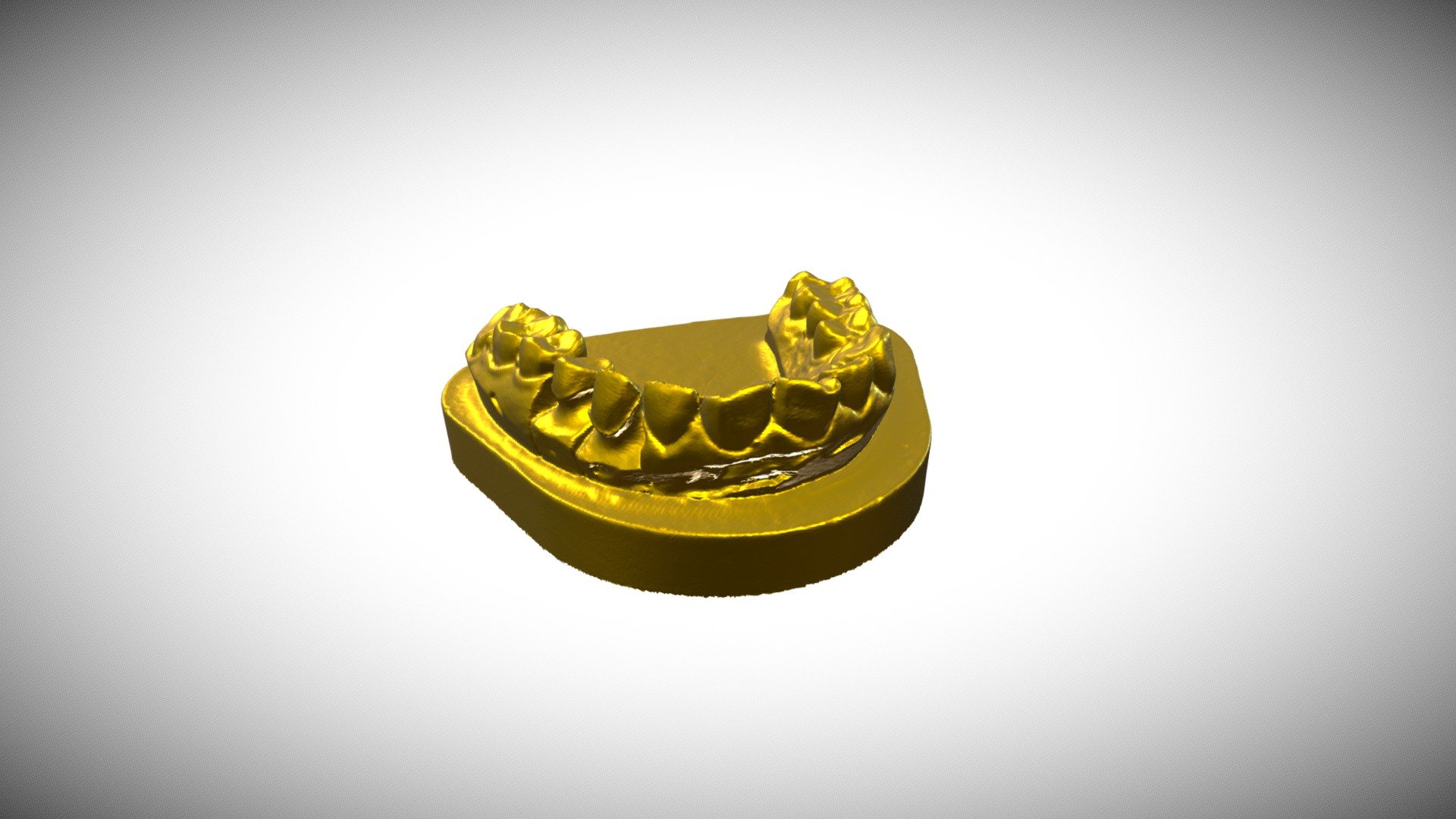 Teeth Model In STL - 3D model by thunk3d.scanner [f0907a6] - Sketchfab