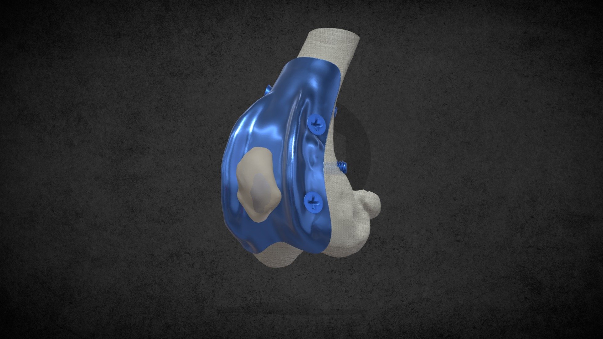 Patellar prosthesis design (ID5514) - 3D model by LimesVet [f0bdf89 ...