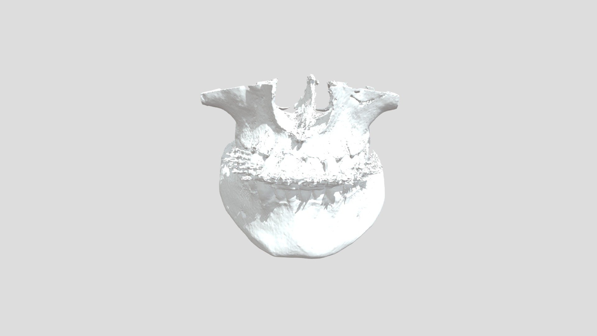 NA_1 NA_1 - 3D model by facedigital.rxodontologico [f0ecfc5] - Sketchfab