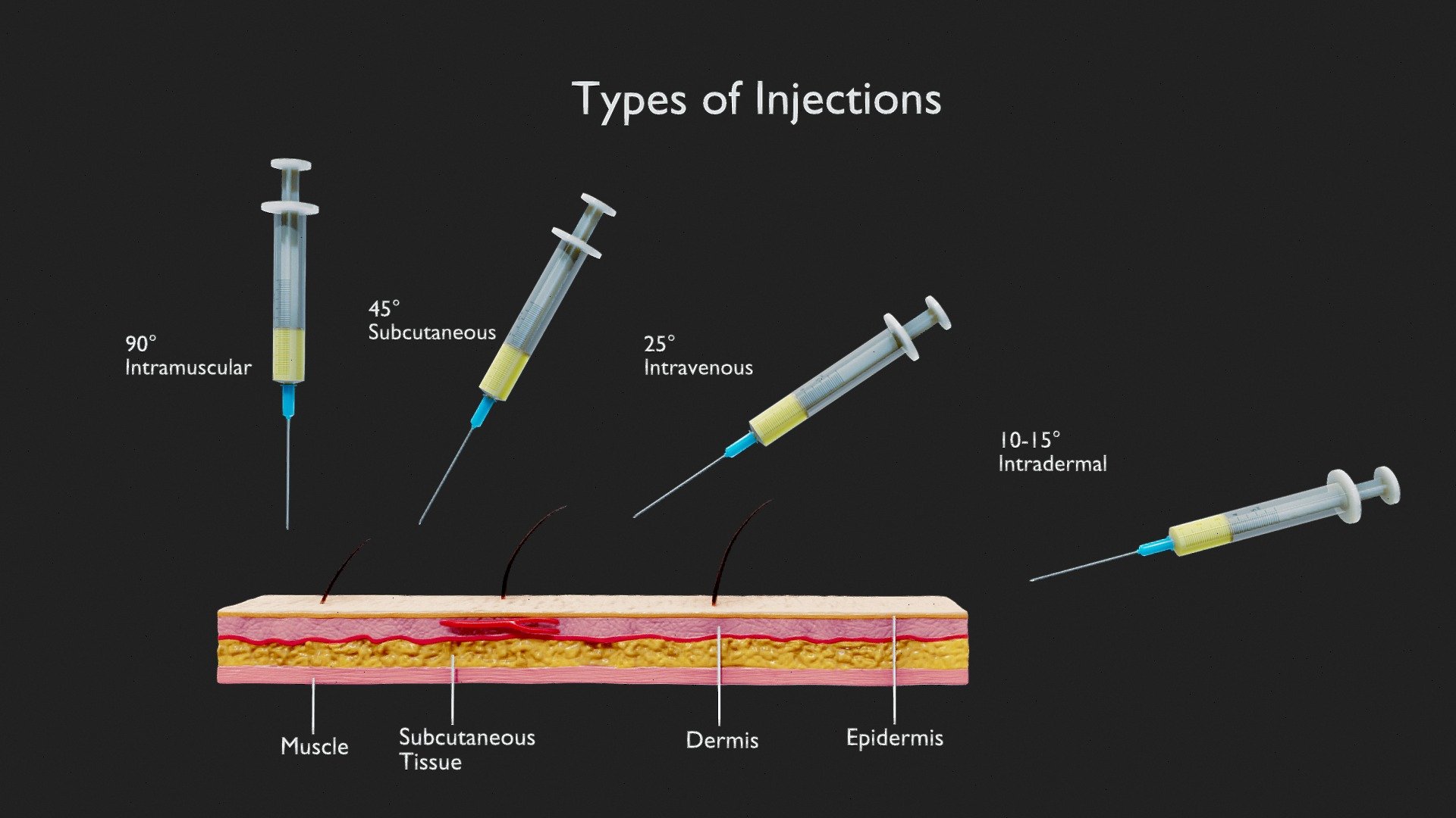 Types of Injections - With Animation - Buy Royalty Free 3D model by ...
