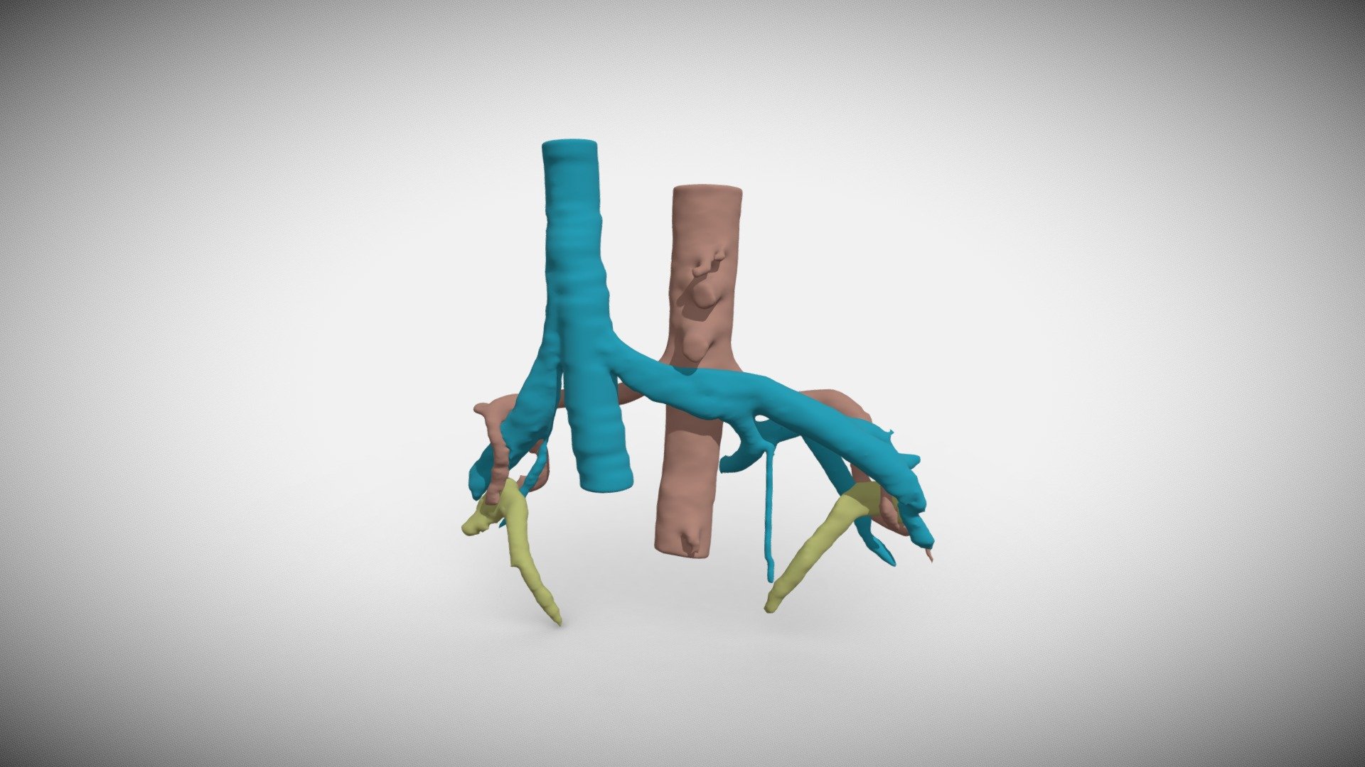 RTX_2_Vessels - 3D model by Imre J. Barabás, MD, M.Sc. (@Uzzias18 ...