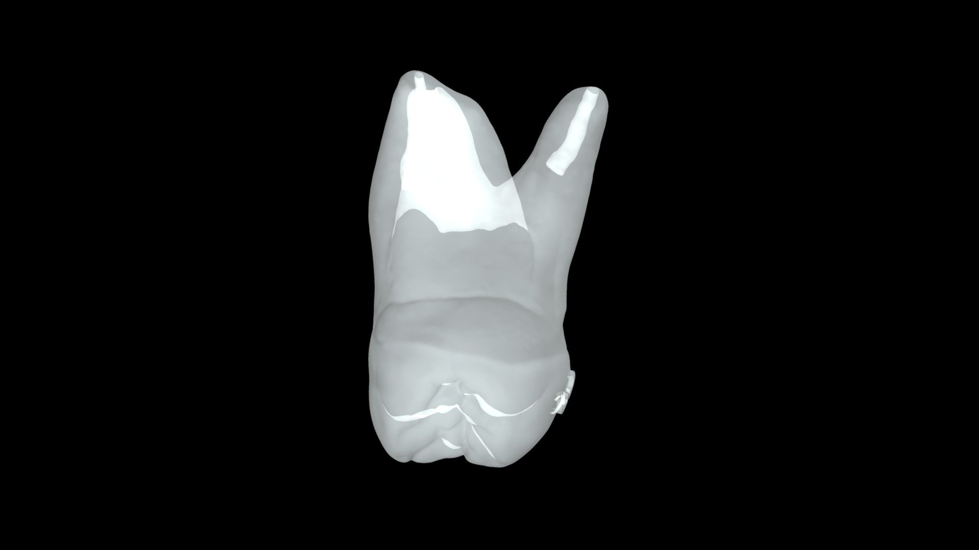 Tooth 3 Calcified - 3D model by biomed3d [f27c51f] - Sketchfab